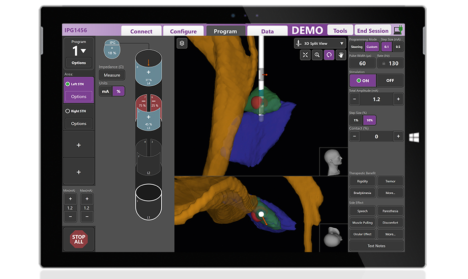 DBS Programming Software - Vercise Genus DBS - Boston Scientific